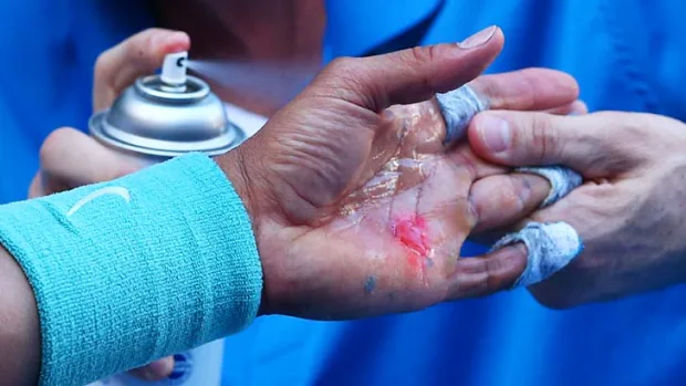 Did Blisters ever decide a Big Match? | Talk Tennis