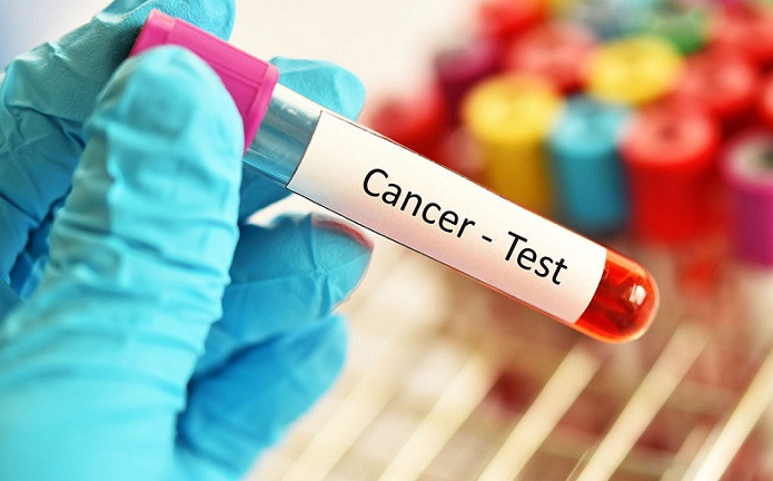 EXÁMENES INDISPENSABLES PARA LA DETECCIÓN TEMPRANA DEL CÁNCER | ADN ...