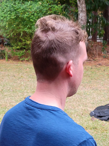 Swollen lumps back of head : r/AskDocs