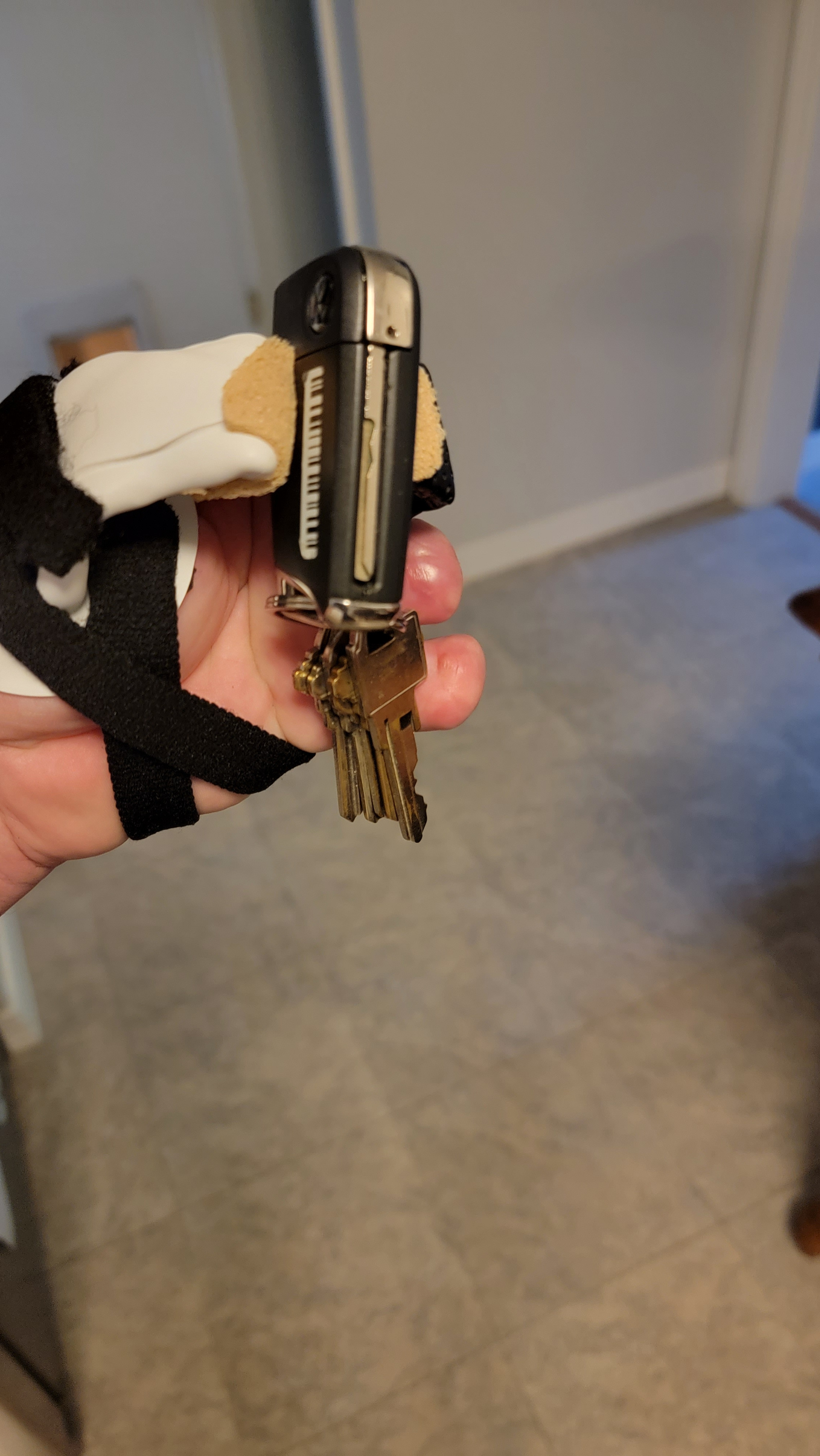 Opra leg prosthetic : amputee